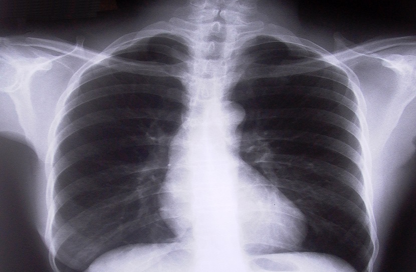 Polacy wciąż mało wiedzą o badaniach rtg. Zaskakujące wyniki sondażu